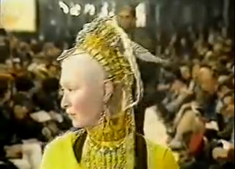 Meet The World’s First Albino Fashion Model From Hong Kong | NextShark.com