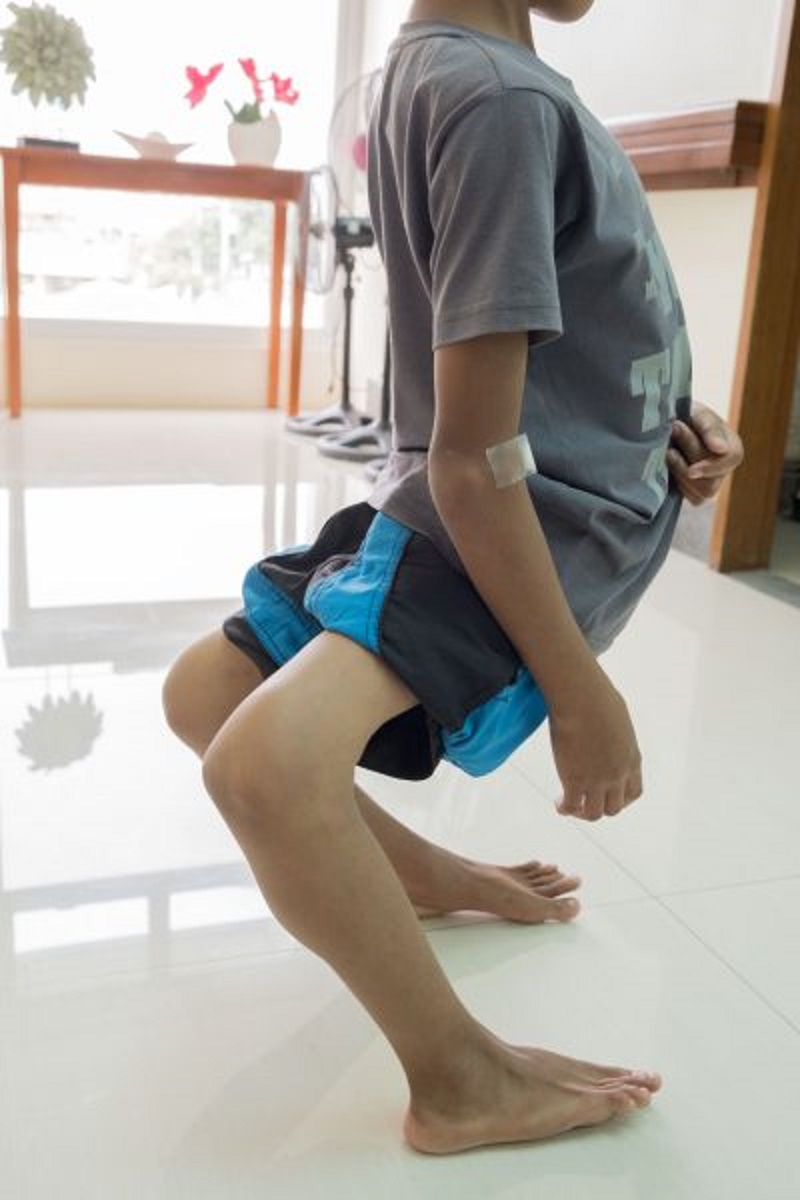 Filipino Boy With Deformed Knees Gets Life Changing Surgery At Tim