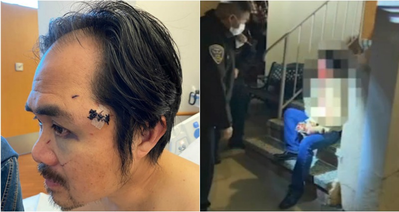 UPDATE: GoFundMe Created For 53-Year-Old SF Asian Man Stabbed in Robbery