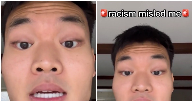 Racism or medical condition?: TikToker finds explanation for why he can ...