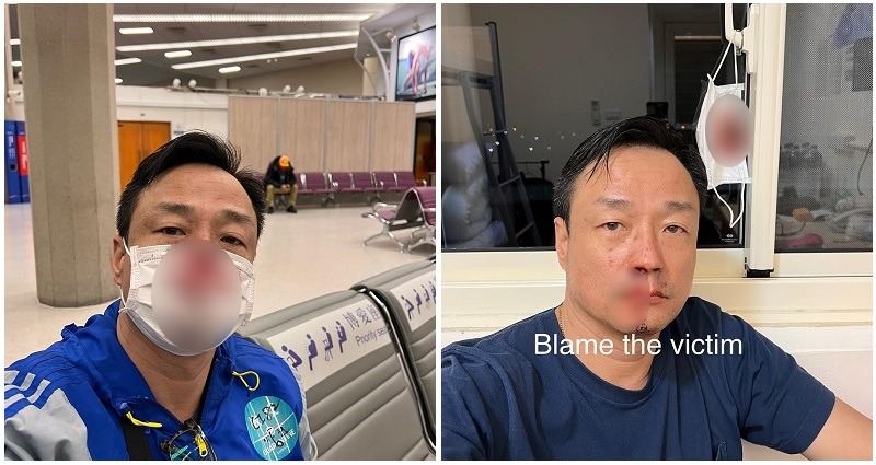 Hong Kong actor Wong He suffers horrifying nosebleed after PCR test in ...