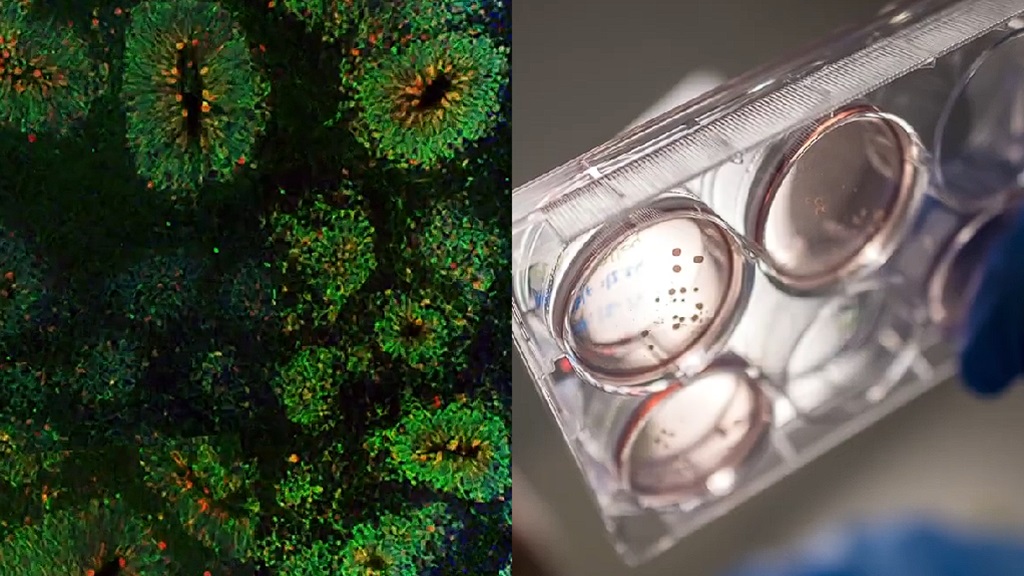 Chinese scientists revive frozen brain tissue without damage in ...